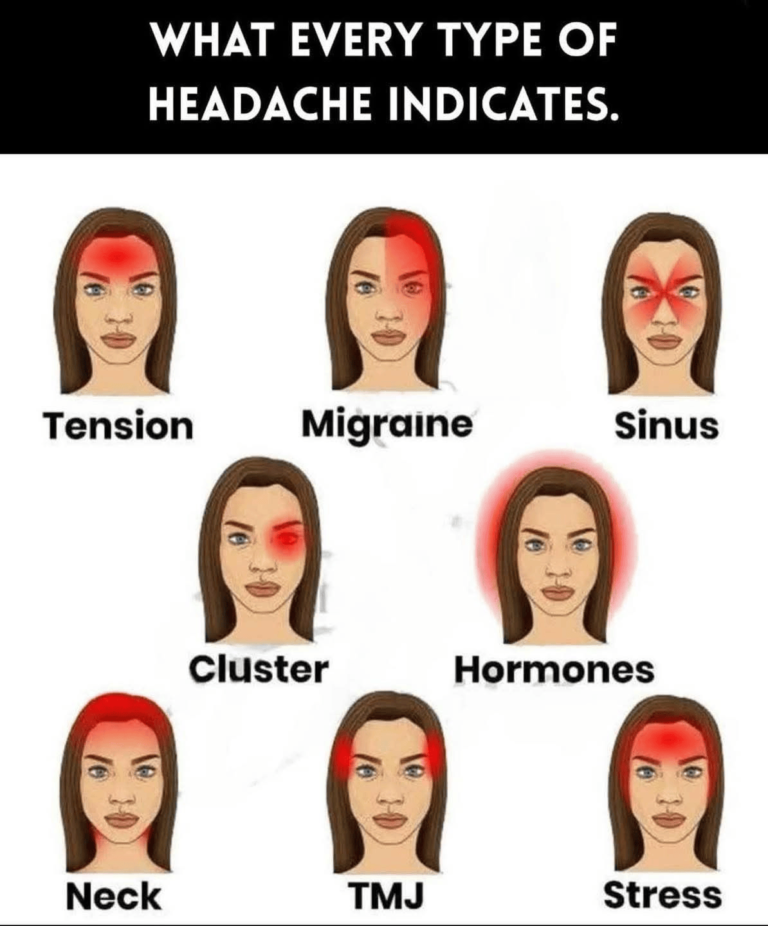 Headache Relief through Physiotherapy : A Complete Guide for Patients ...